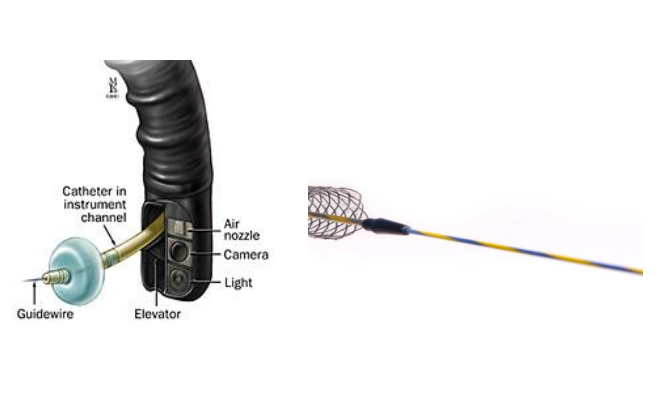 Medical Instrument Electric Polypectomy Snare - FESHIN